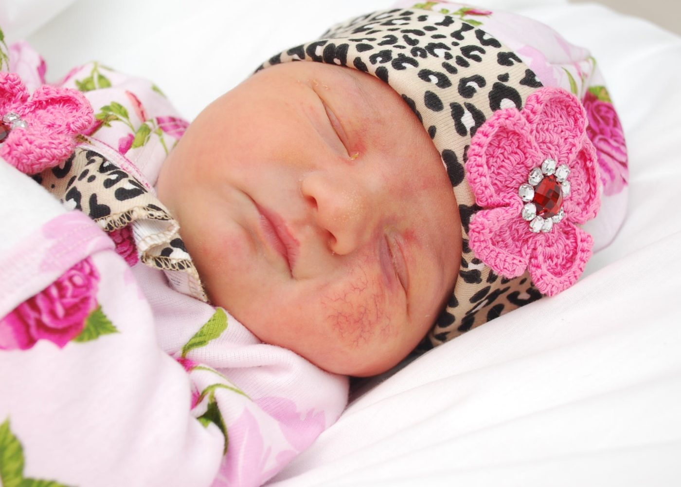 Plastic Surgery Archives - CHOC Provider Blog