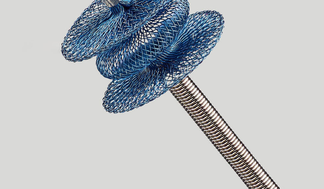 CHOC team using new device to close heart defect in tiny patients ...