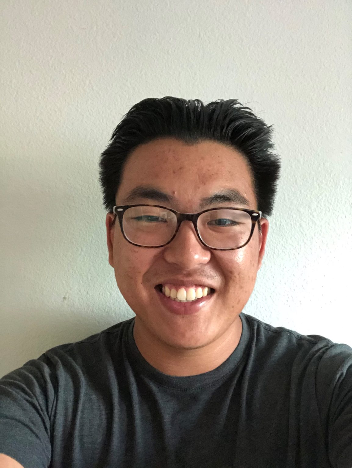 CHOC intraventricular hemorrhage and hydrocephalus patient accepted to ...