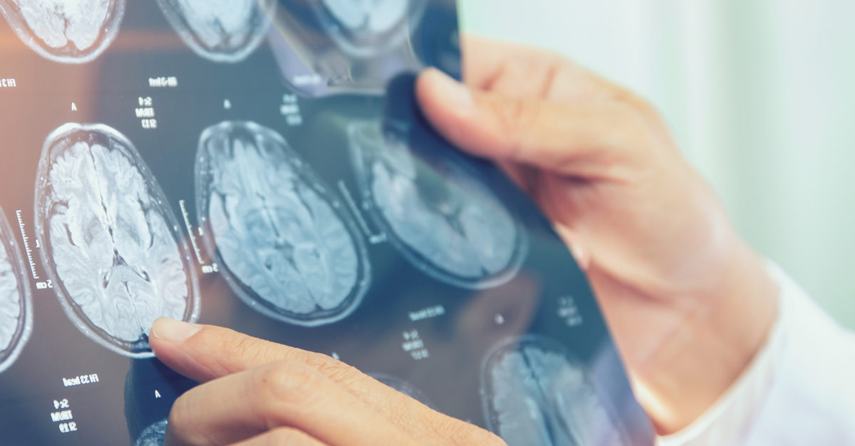 Treating neonatal arteriovenous malformation with surgery