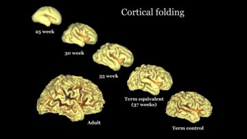 Welcome Dr. Terrie Inder, chair of Center of Neonatal Research at CHOC