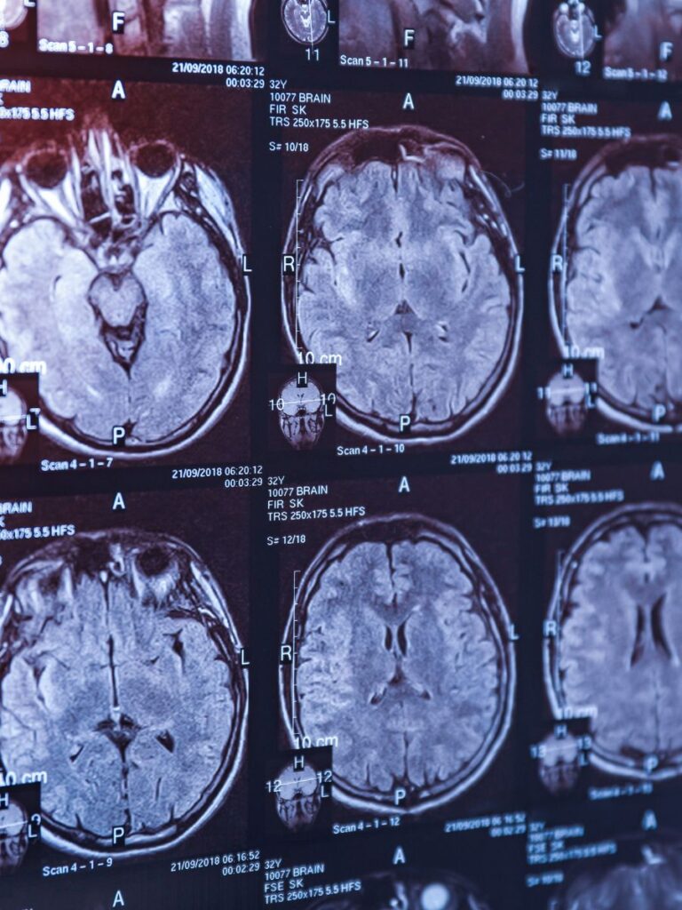 All Articles - CHOC Pediatrica