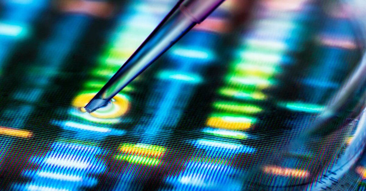 Searching for a cure at CHOC’s Rett Syndrome Center of Excellence ...