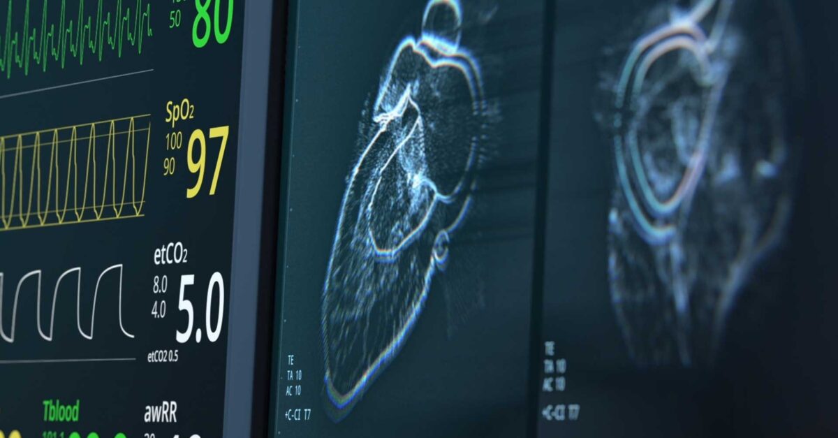 CHOC-led study explores cardiac MRI for borderline left ventricle surgery